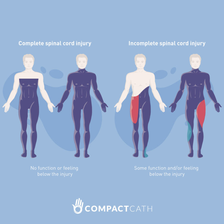 Spinal Cord Injuries and Neurogenic Bladders - CompactCath